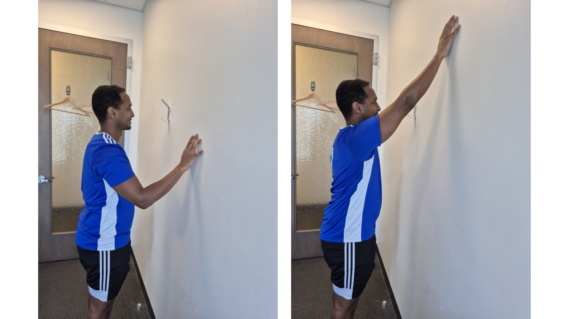 Post Surgical Shoulder Rehab - Physiotherapy Toronto